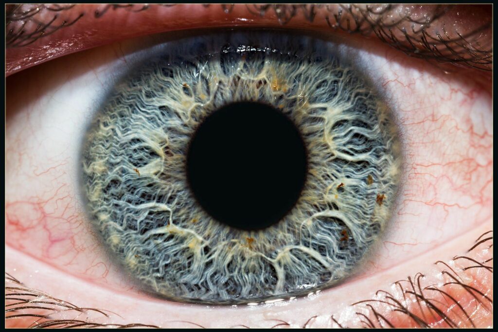 What Causes People to Have Different Eye Color? | Eye Health