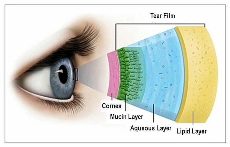 6 Reasons Why You Have Crusty Eyes in the Morning